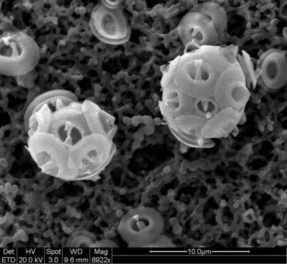 Las algas revelan que el efecto invernadero calentó la Tierra hace ...