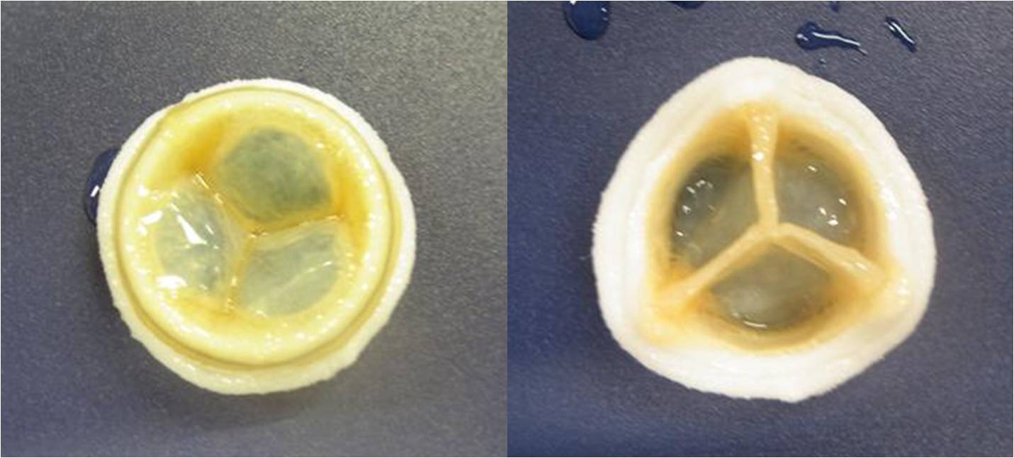 Mejoran la fiabilidad de las válvulas cardiacas artificiales / Noticias ...